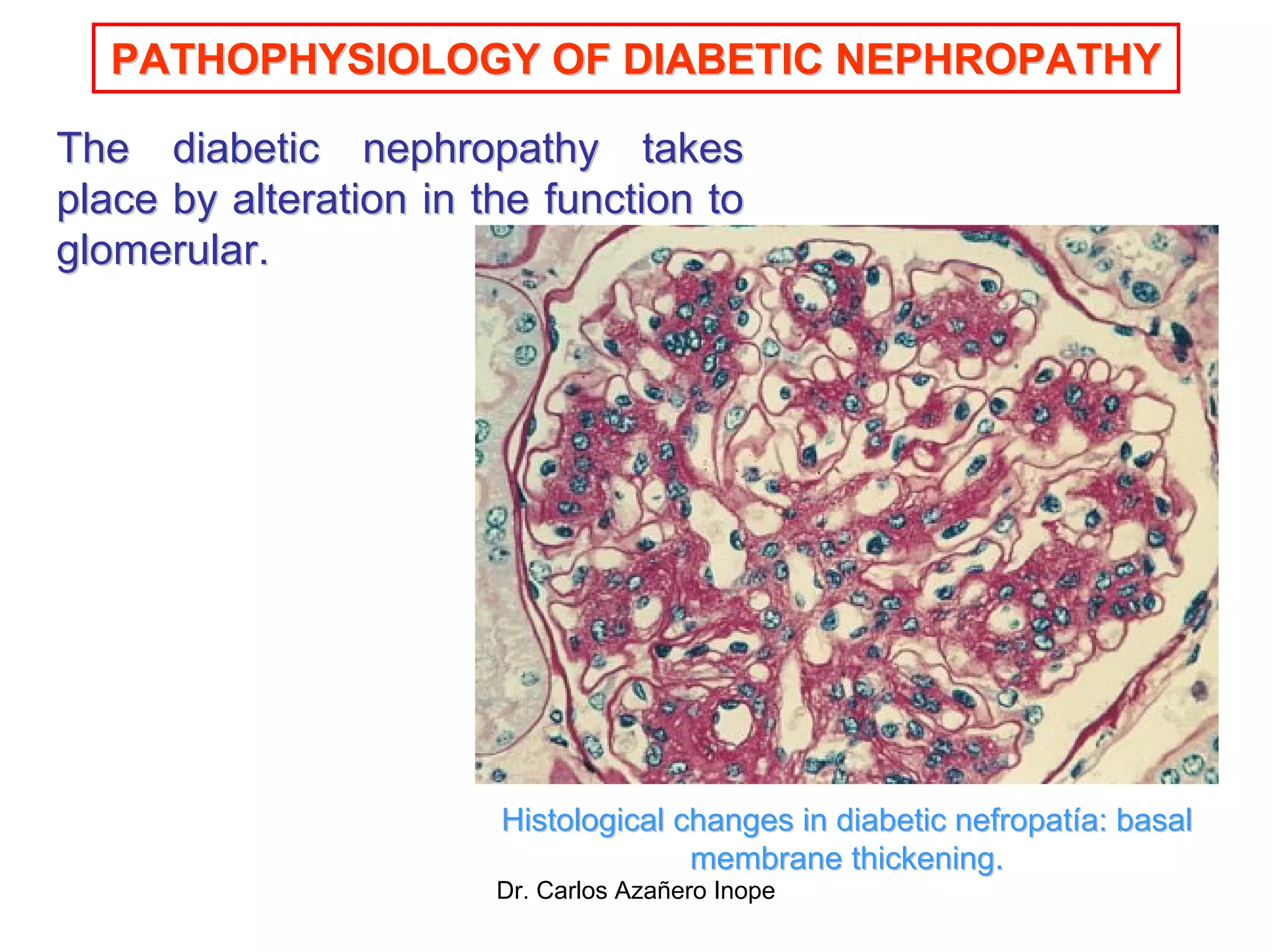 PATHOPHYSIOLOGY OF DIABETIC NEPHROPATHY | PDF