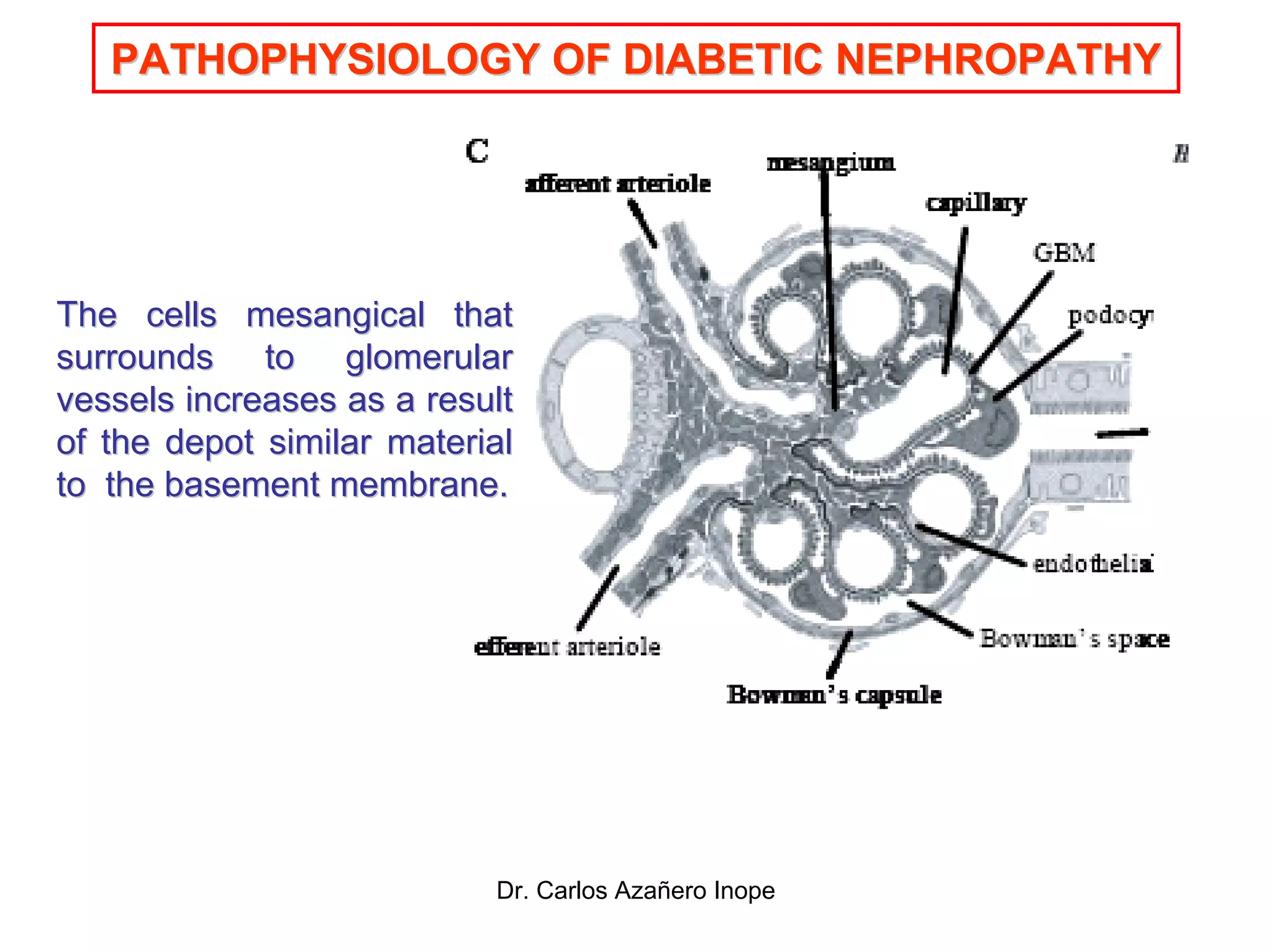 PATHOPHYSIOLOGY OF DIABETIC NEPHROPATHY | PDF