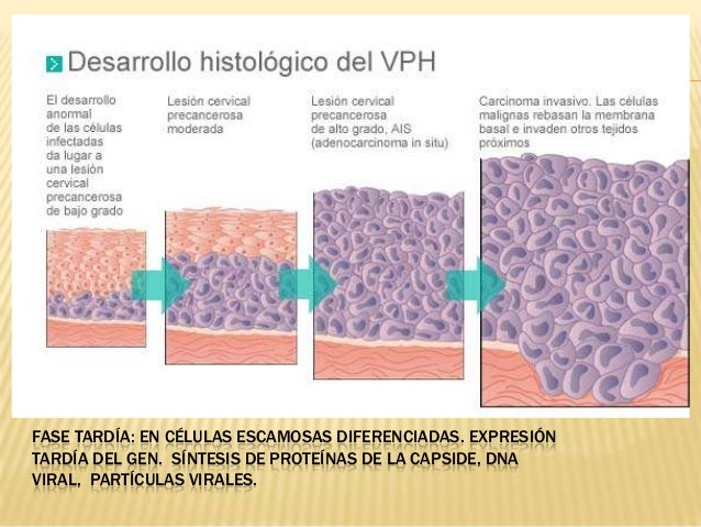 Fisiopatologia de la infeccion del virus del papiloma