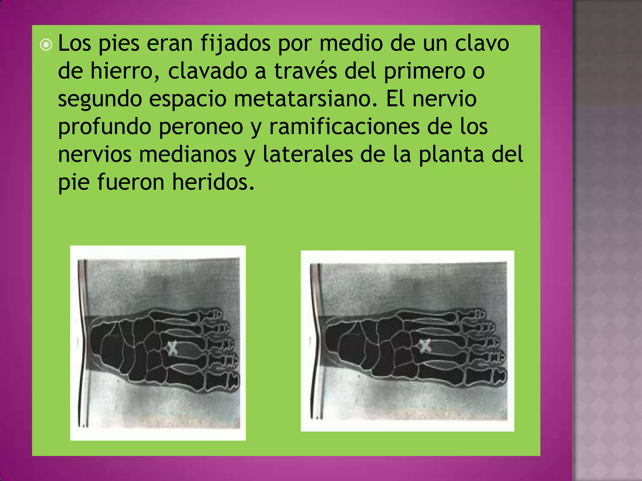 Fisiopatologia De La Muerte De Jesucristo | PPTX