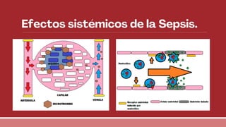 FISIOPATOLOGIA DE LA SEPSIS LASTRES MENESES JAIR ALEXANDRE.pdf