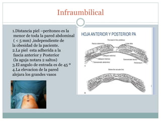 Fisiopatologiadelneumoperitoneo | PDF