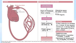 Fisiopatología del Shock Obstructivo 2.pdf