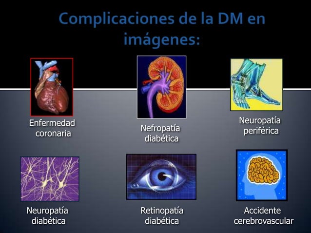 Fisiopatologia dm2 | PPTX
