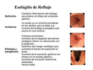 Fisiopatologia esofago | PPT