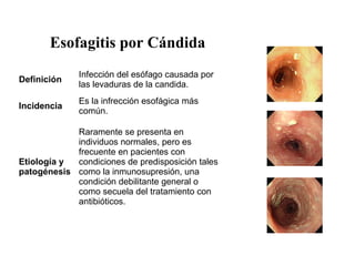 Fisiopatologia esofago | PPT