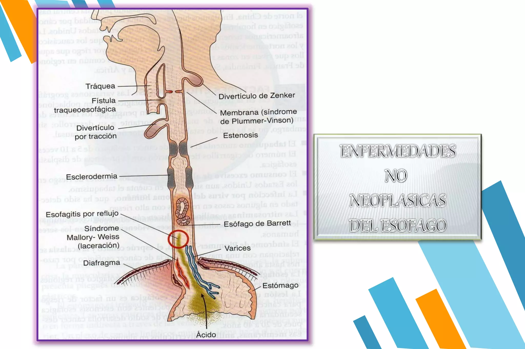 Fisiopatología Esófago y Gastrica.pptx