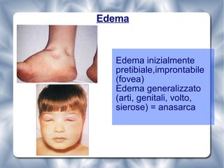 Fisiopatologia Renale | ODP