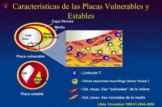 Fisiopatologia Síndrome Coronario Agudo | PPT