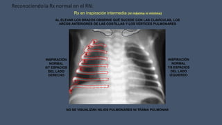 FISIOPATOLOGIA TORAX NORMAL.pdf