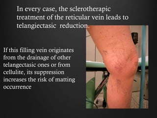 Useful physiopathology of telangectasia | PPT