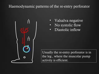 Useful physiopathology of telangectasia | PPT