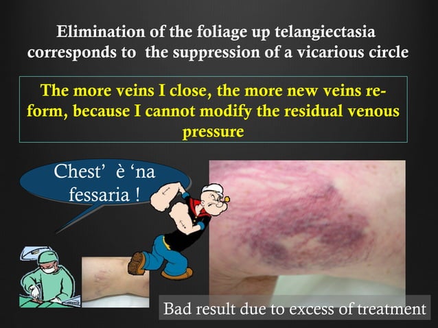 Useful physiopathology of telangectasia | PPT | Blood Disorders ...