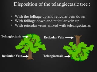 Useful physiopathology of telangectasia | PPT