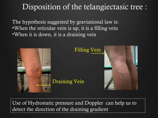 Useful physiopathology of telangectasia | PPT