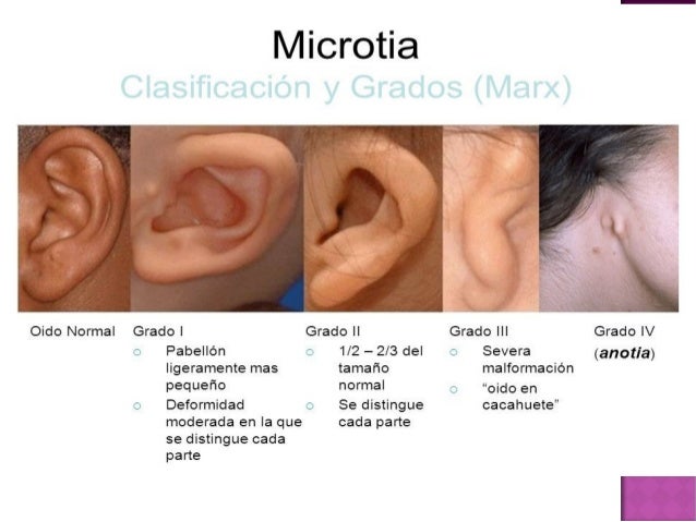 Audición y equilibrio, anatomía