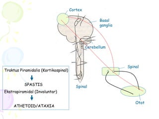 Fisioterapi-Pediatri-Pertemuan-4.ppt. b. | PPT