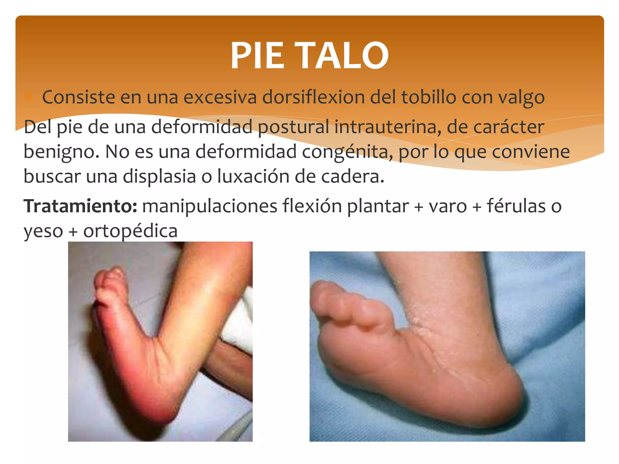 Fisioterapia en pediatria tema: alteraciones de los pies | PPTX
