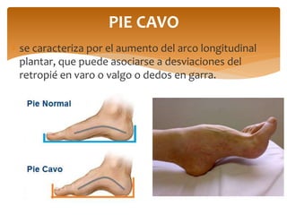 Fisioterapia en pediatria tema: alteraciones de los pies | PPTX