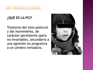 Fisioterapia y parálisis cerebral infantil | PPTX