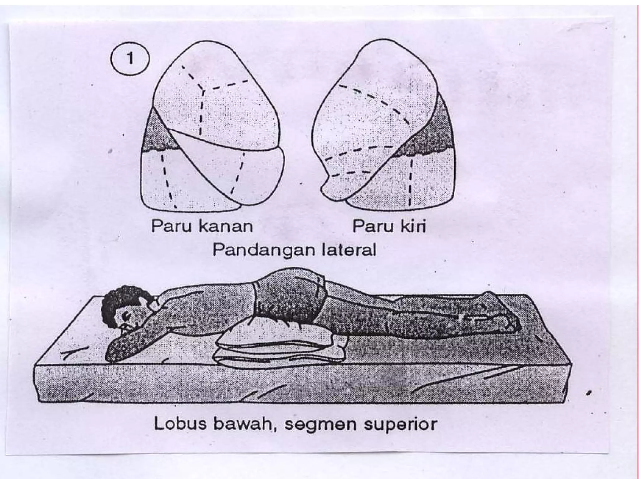 Fisioterapi dada.ppt