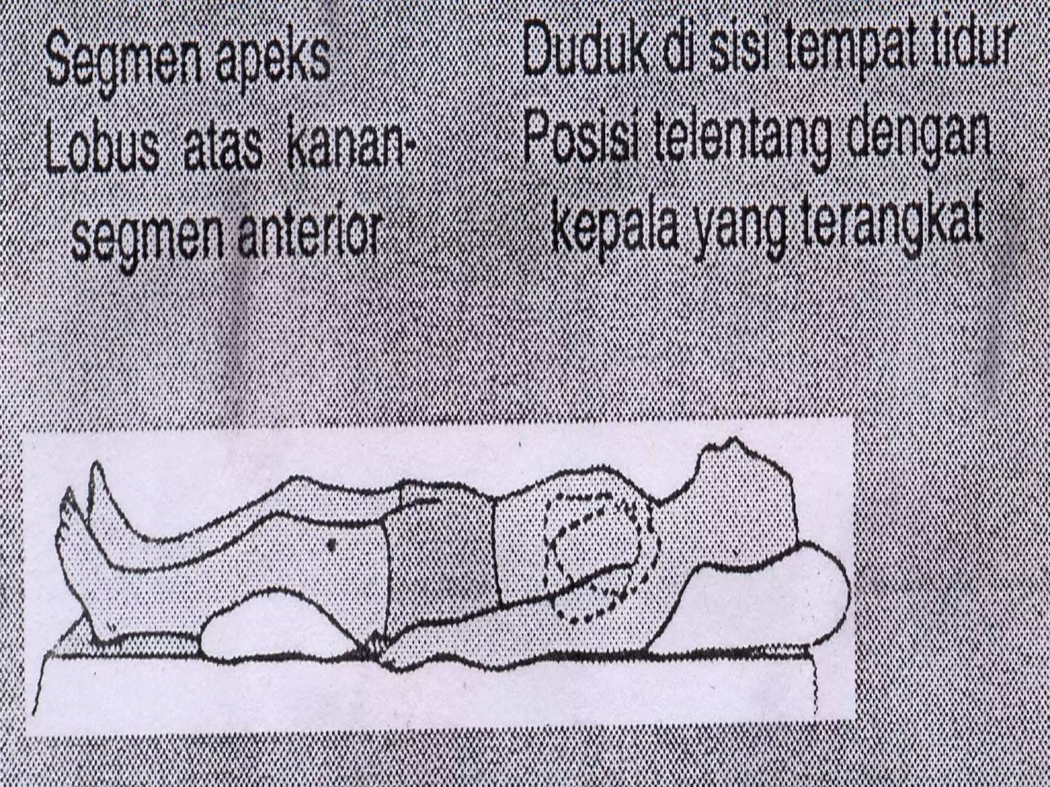 Fisioterapi dada.ppt