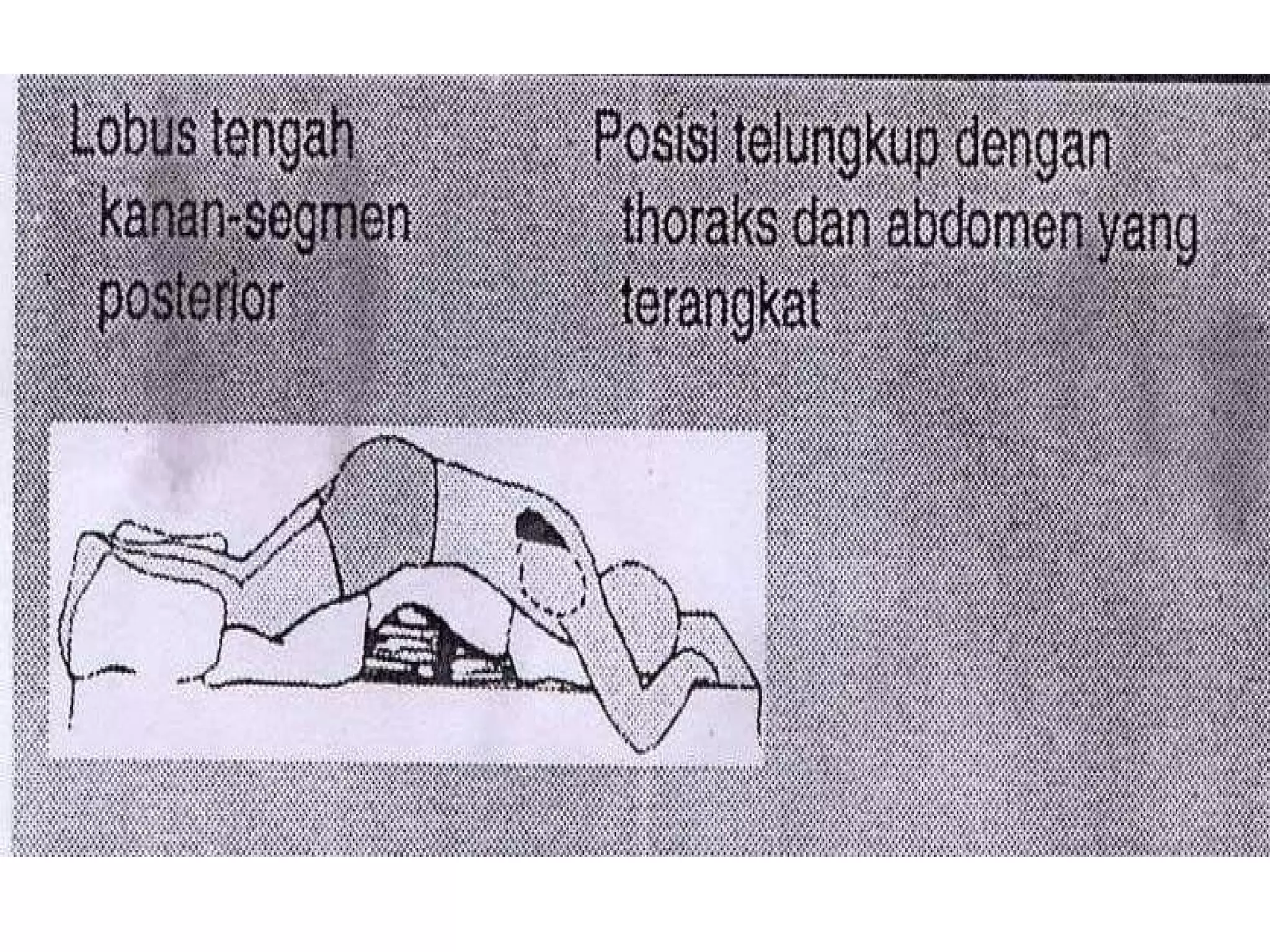 Fisioterapi dada.ppt