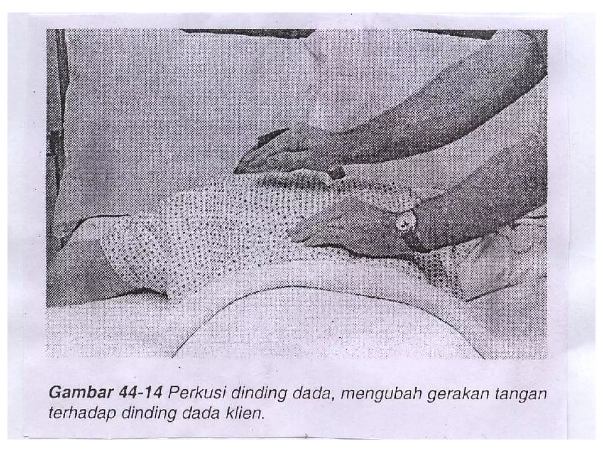 Fisioterapi dada.ppt