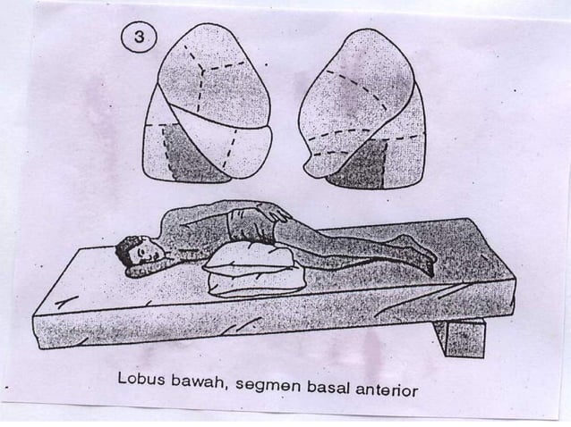 Fisioterapi dada.ppt