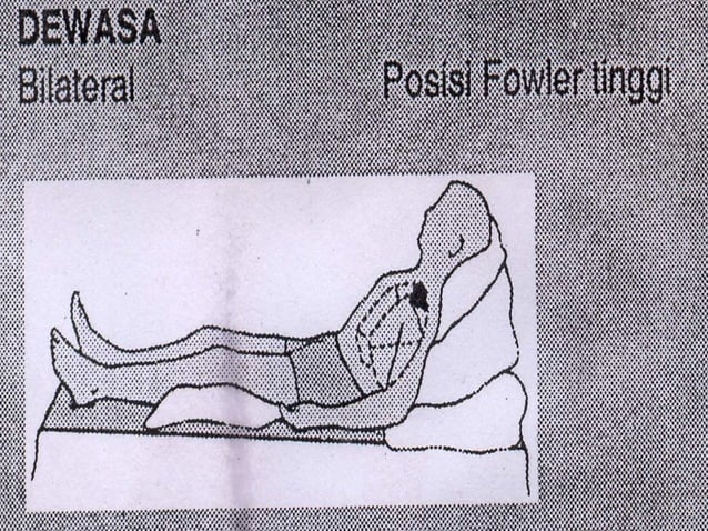 Fisioterapi dada.ppt