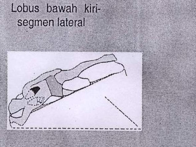 Fisioterapi dada.ppt