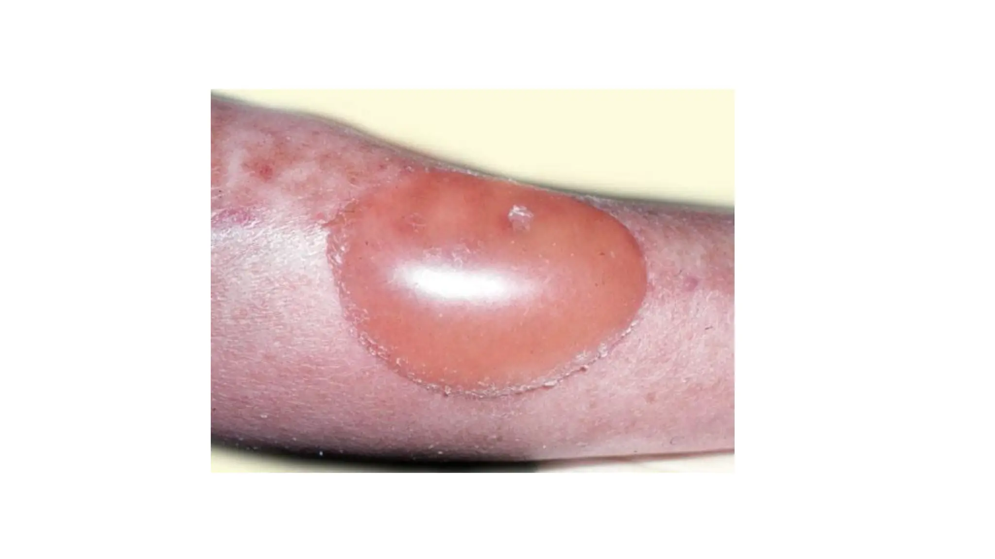 fisioterapi integumennnnnnnnnnnnnnnnnnnn | PPT