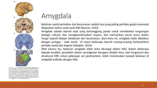 FISIOTERAPI PADA AUTISM SPECTRUM DISORDERS (ASD).pptx