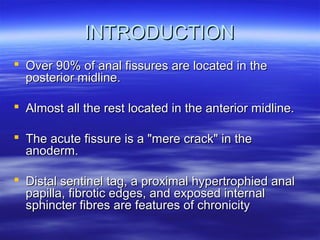 Fissure | PPT