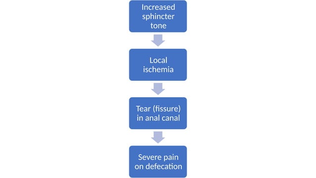 fissures.pptx/////////////////////////// | PPT