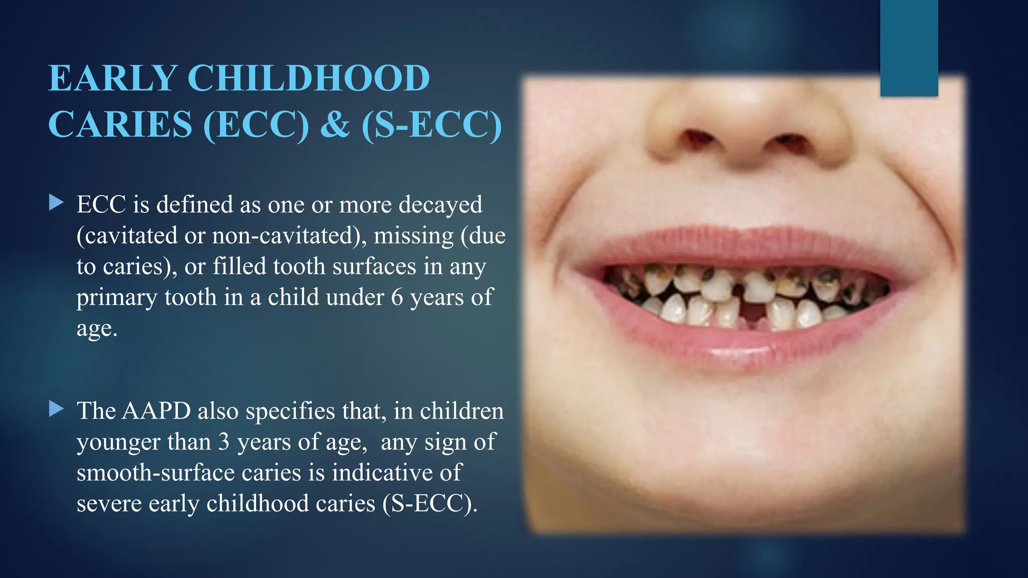 Fissure Sealant & ECC fissure dentally.pptx