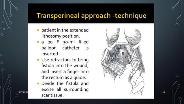 Fistulae excluding gu fistula | PPT