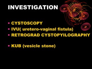 Fistula | PPT