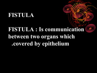 Fistula | PPT