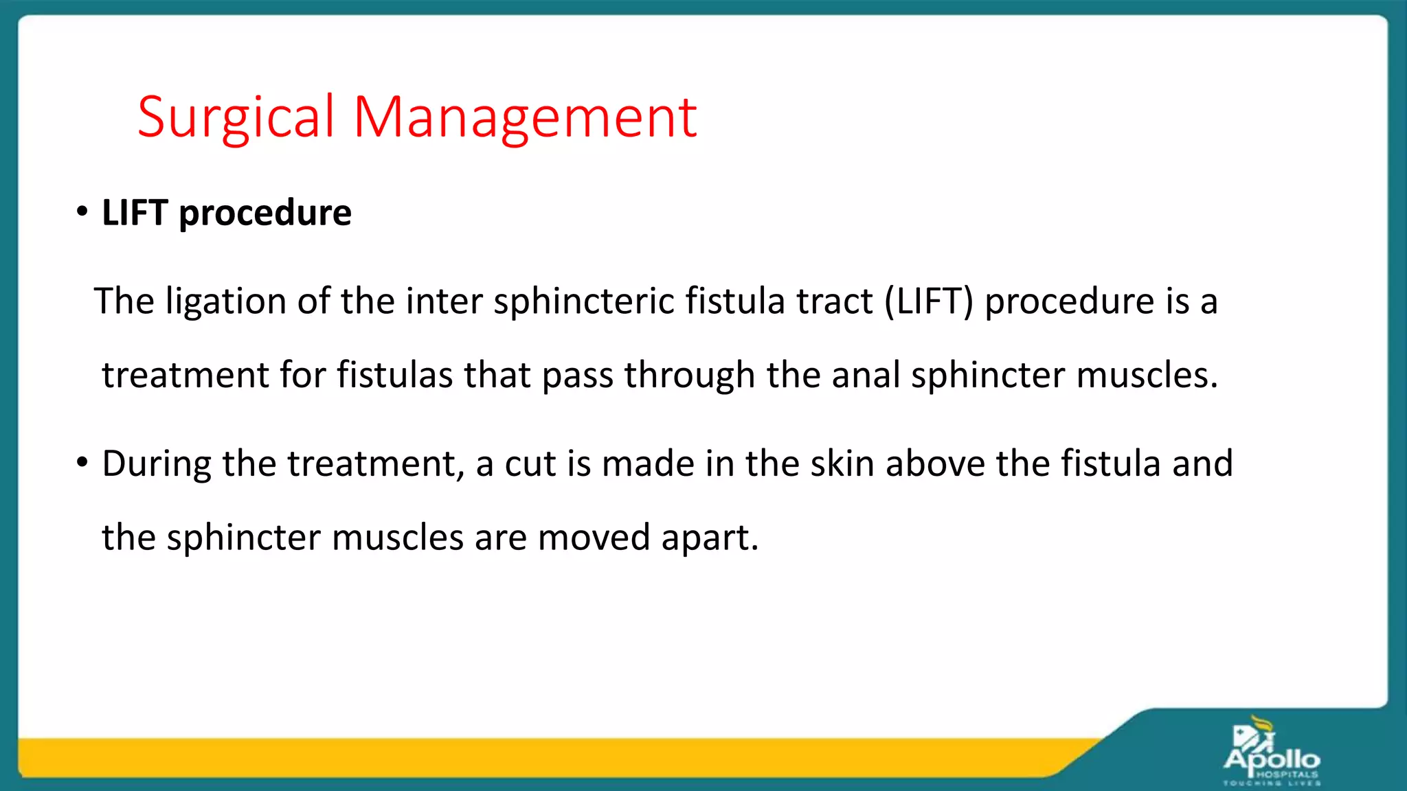 fistula.pptx