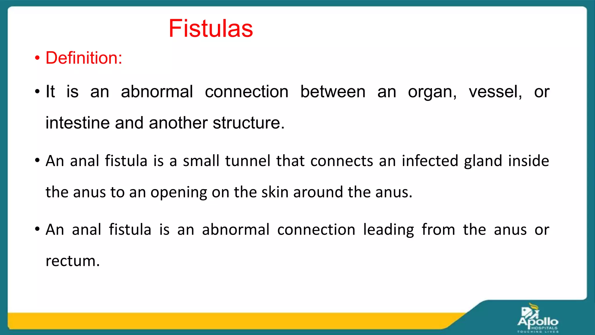 fistula.pptx