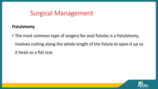 fistula.pptx