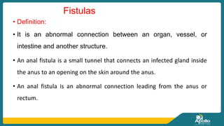 fistula.pptx