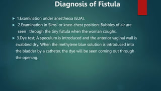 Fistula and various types in obstetrics and gynecological nursingpptx ...