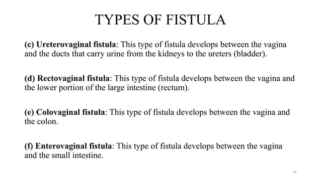 A slide on Fistula and its management.pptx