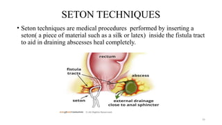 A slide on Fistula and its management.pptx