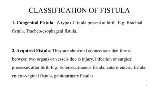 A slide on Fistula and its management.pptx