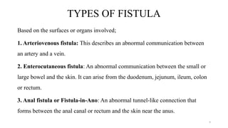 A slide on Fistula and its management.pptx