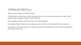 fistula power point presentation finstula | PPTX