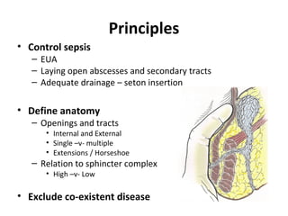 Fistula in-ano | PPT